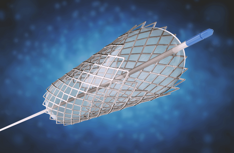 Colon Stenting Procedures at Crest Surgical Practice